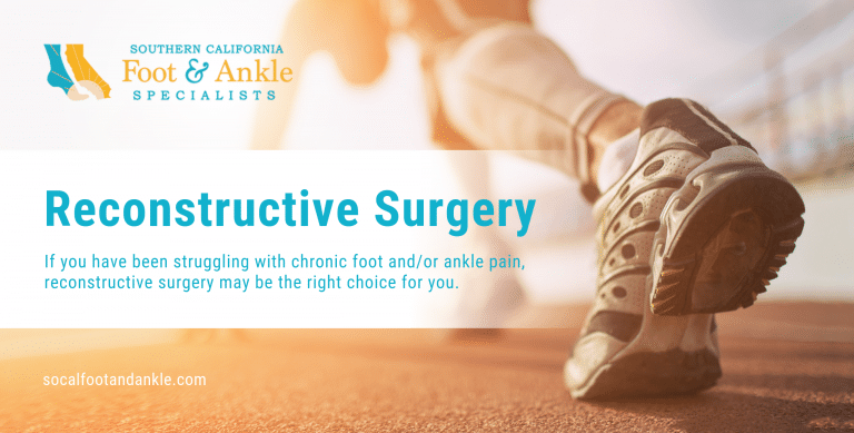 Reconstructive Surgery - Southern California Foot & Ankle Specialists